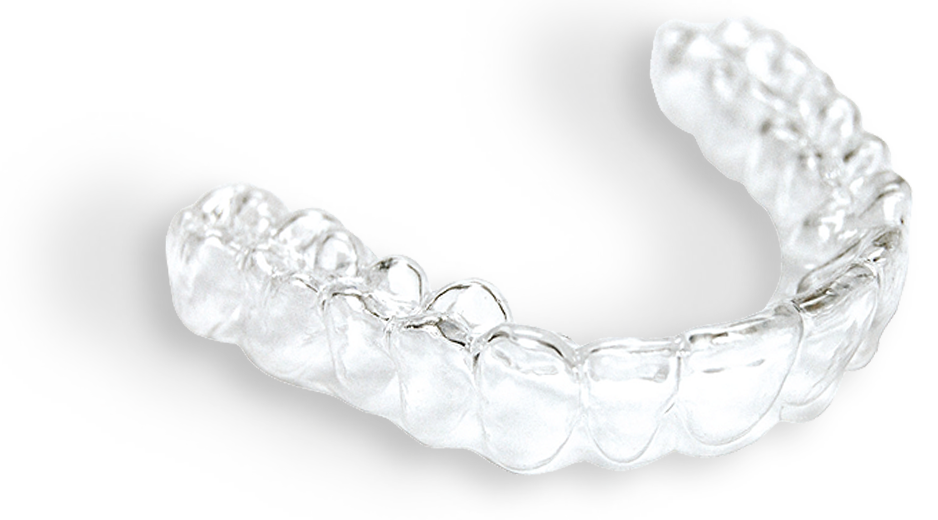 Benefits of Clear Aligners | Illusion Aligners